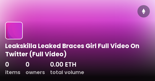 Leakskilla Leaked Braces Girl Full Video On Twitter Full Video