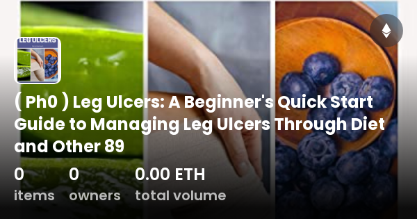 ( Ph0 ) Leg Ulcers: A Beginner's Quick Start Guide to Managing Leg ... ( Ph0 ) Leg Ulcers: A Beginner's Quick Start Guide to Managing Leg ...