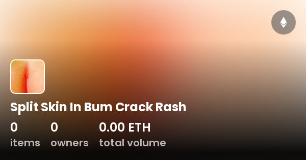 Split Skin In Bum Crack Rash Collection Opensea